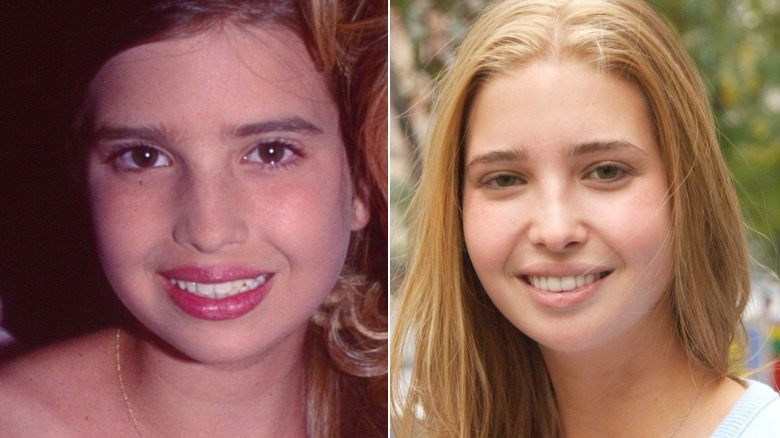 Ivanka Trump's Teeth Transformation Hints Her Perfect Smile Is Fake