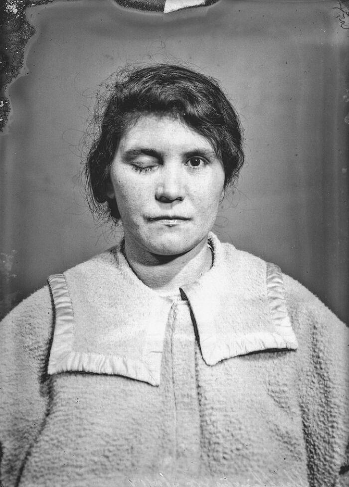 13 Haunting Medical Portraits Of Harvey Cushing’s Patients In The Early ...