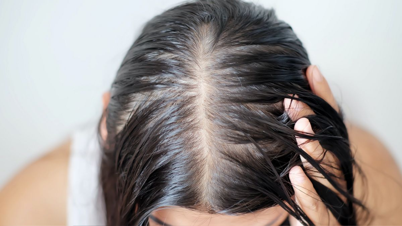 Is scalp inflammation secretly sabotaging your hair?