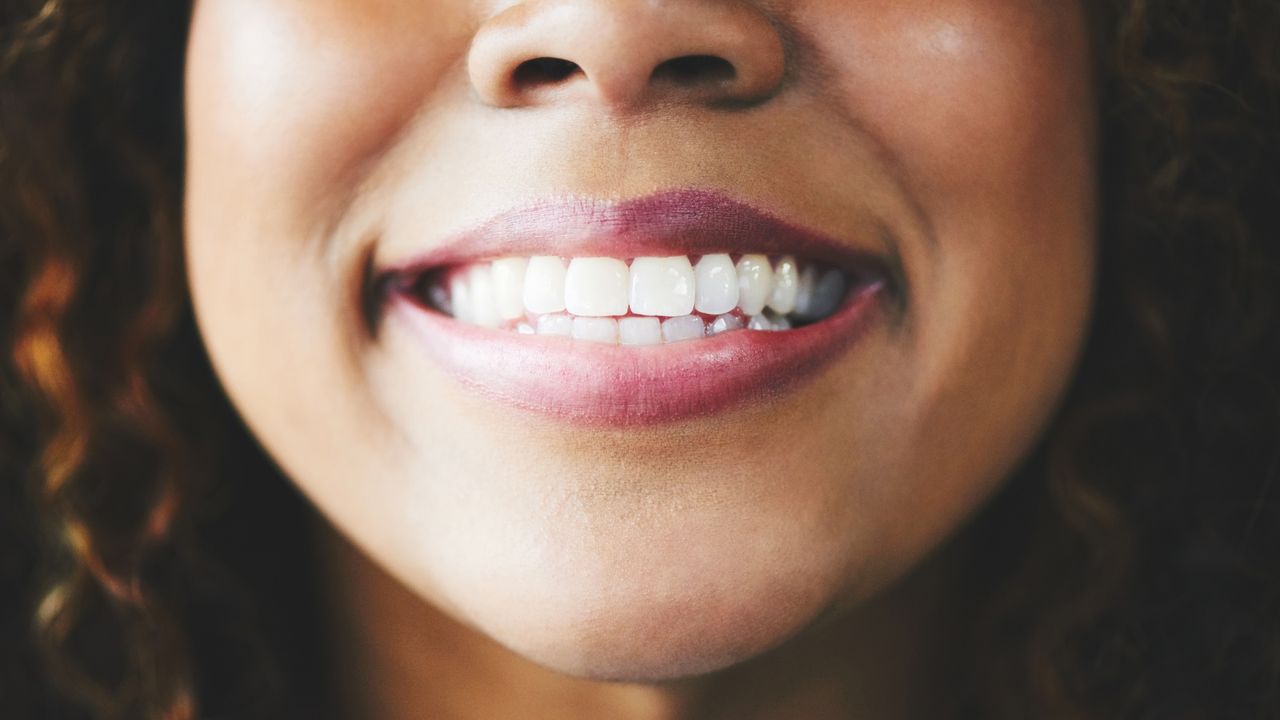 Keratin extracted from sheep's wool repairs teeth in breakthrough