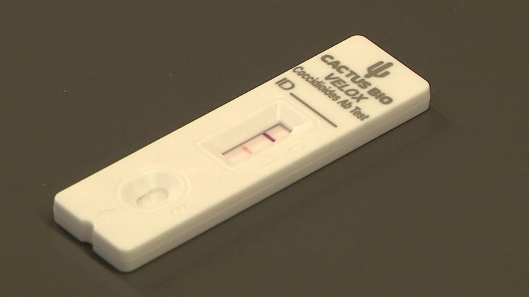 Valley Fever: ASU, Mayo Clinic team up to develop new test