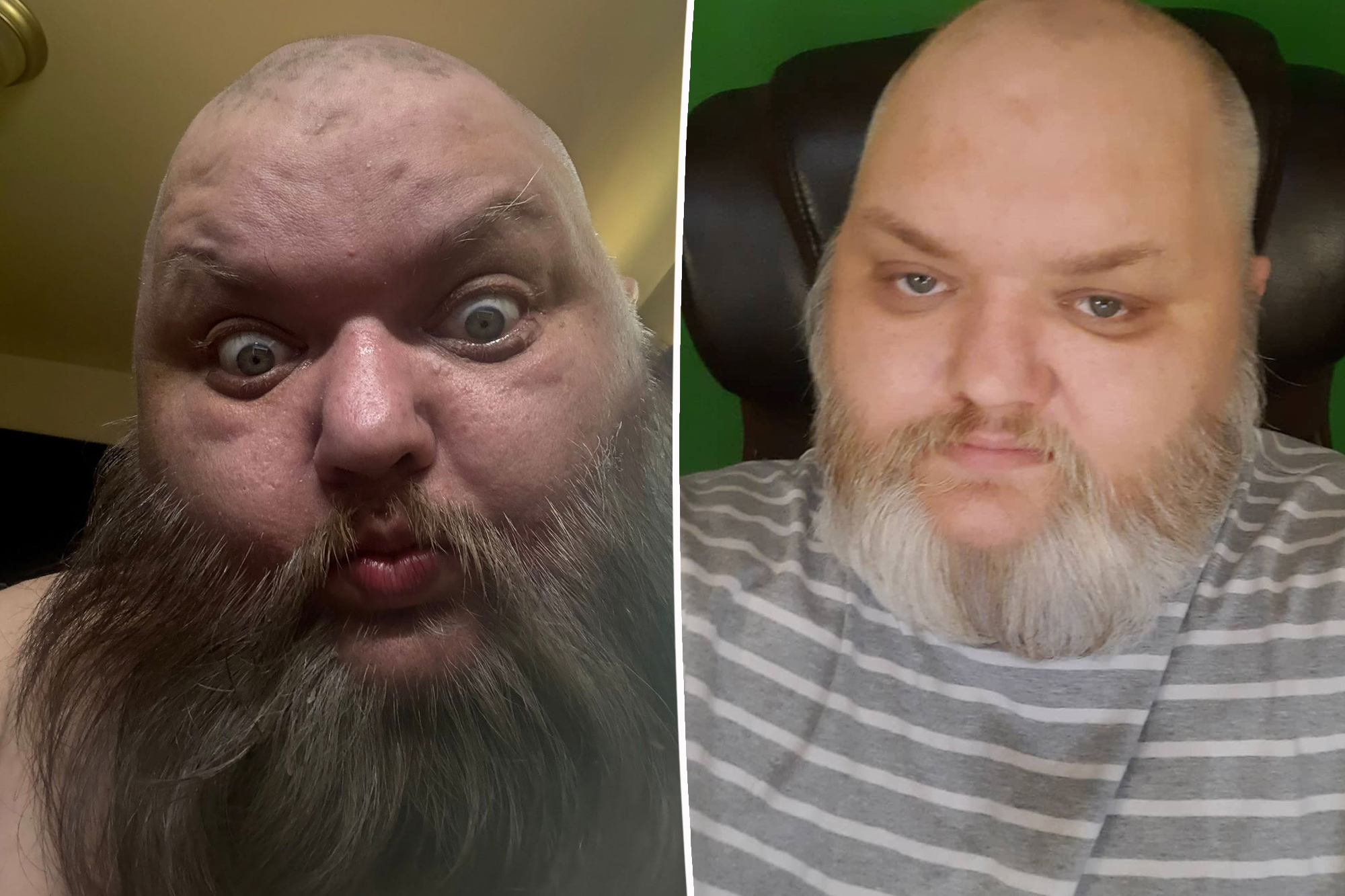 TikTok star John Crawley, known as ‘KingBeardX,’ dead at 47