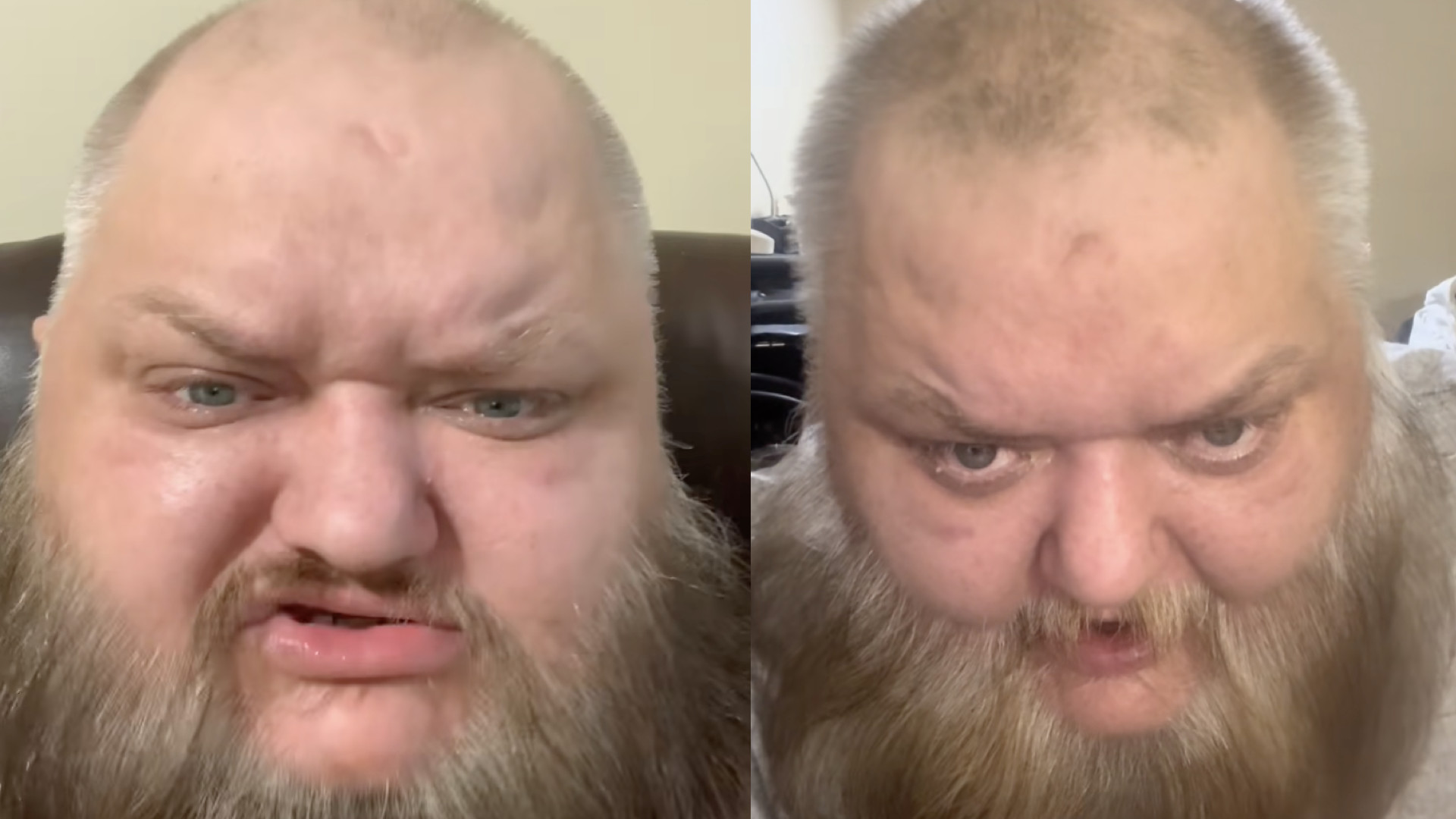 TikTok Personality John Crawley AKA 'KingBeardX' Dead at 47