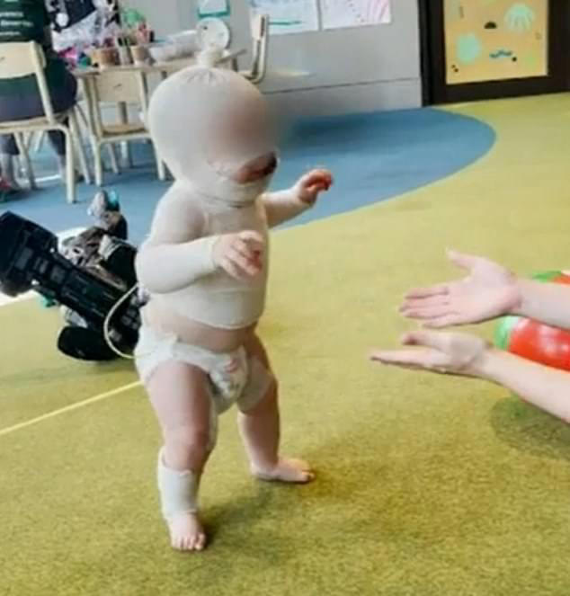 Unexpected twist in baby scalded with hot coffee saga