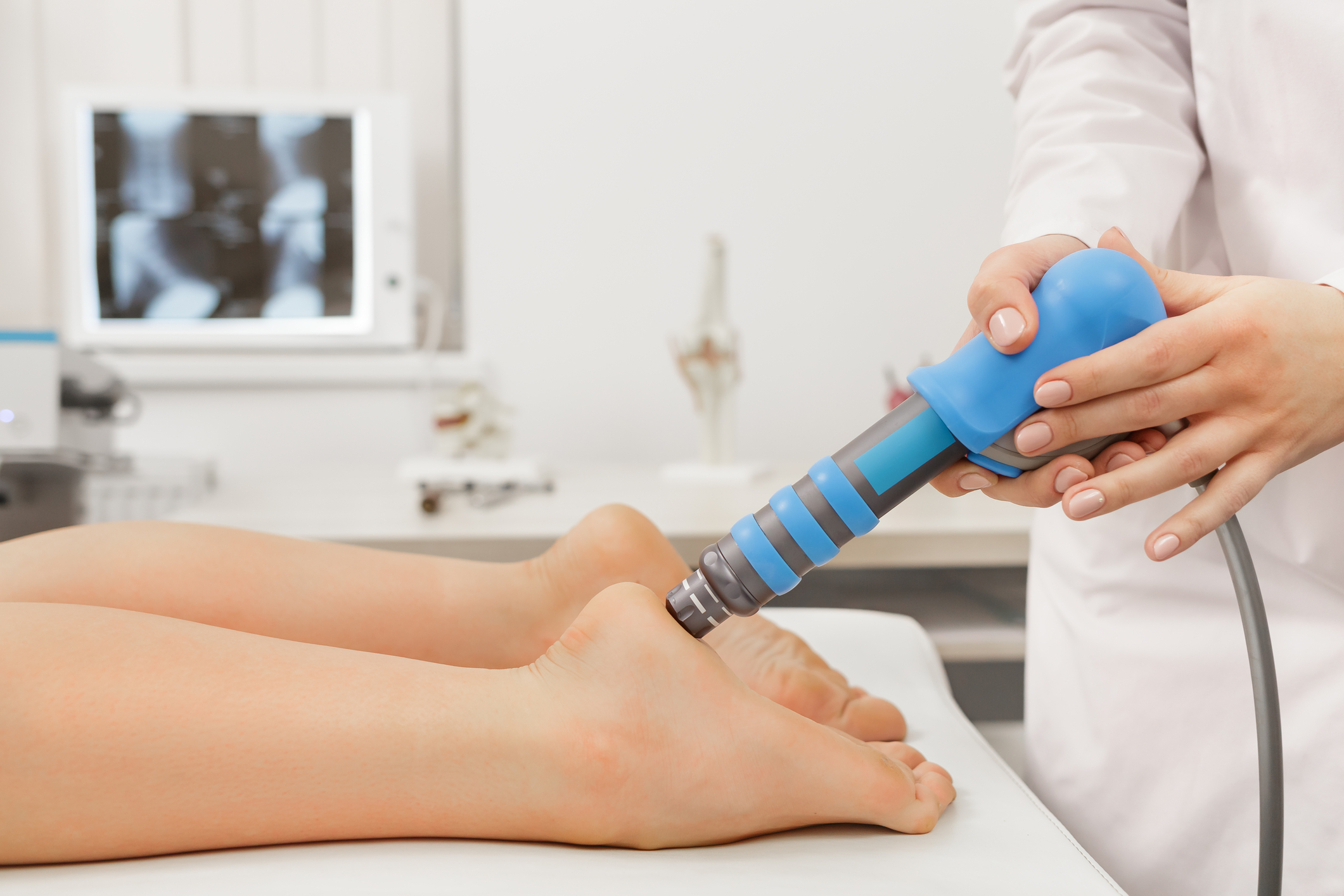 Mayo Clinic Q&A: Shockwave therapy may help relieve foot problem
