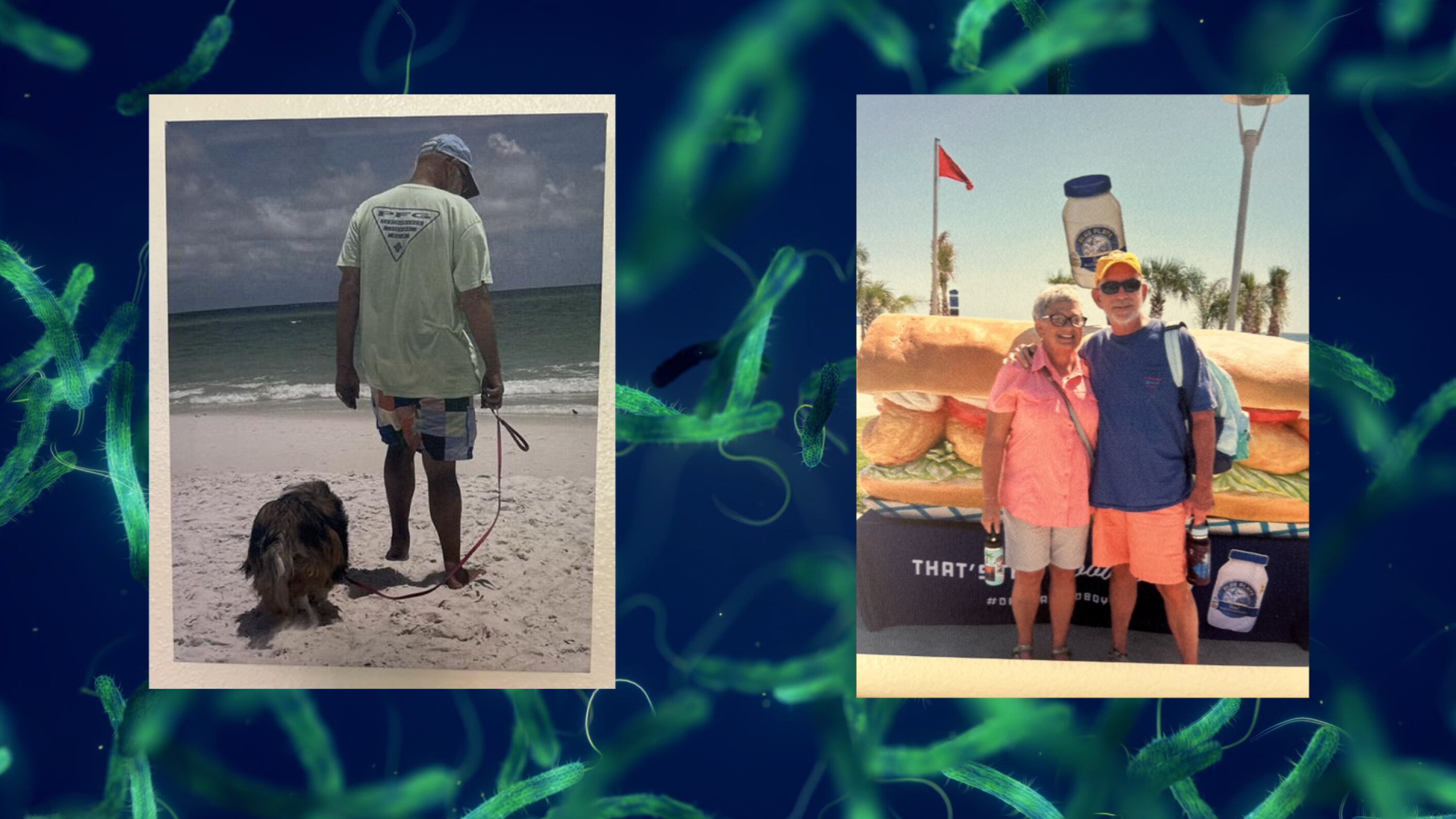 Flesh-eating bacteria cases on the rise, health experts sounding the alarm
