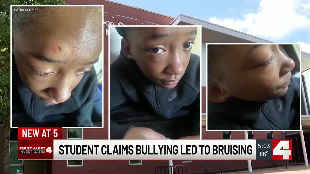 Hazelwood middle school fight leaves student with scar and swollen eye ...