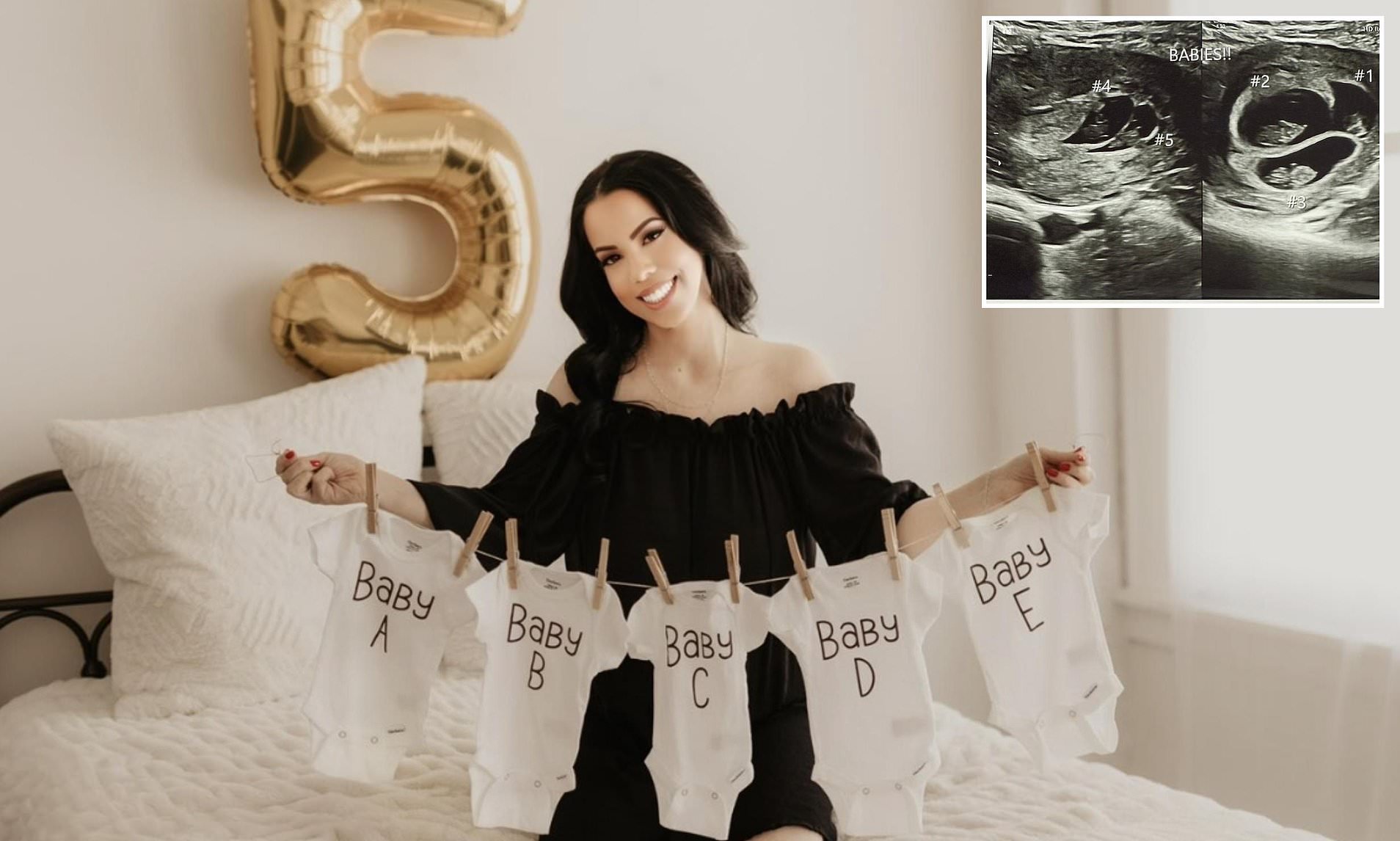 Woman who is a quadruplet gives birth to five babies in 1-in-47million case