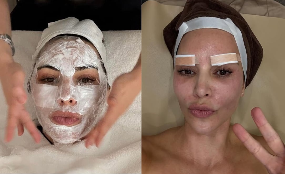 Kim Kardashian Shares K-Beauty Treatments in Seoul Photos