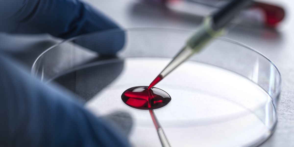 This Tiny Blood Test Could Revolutionize Disease Diagnosis. Experts ...