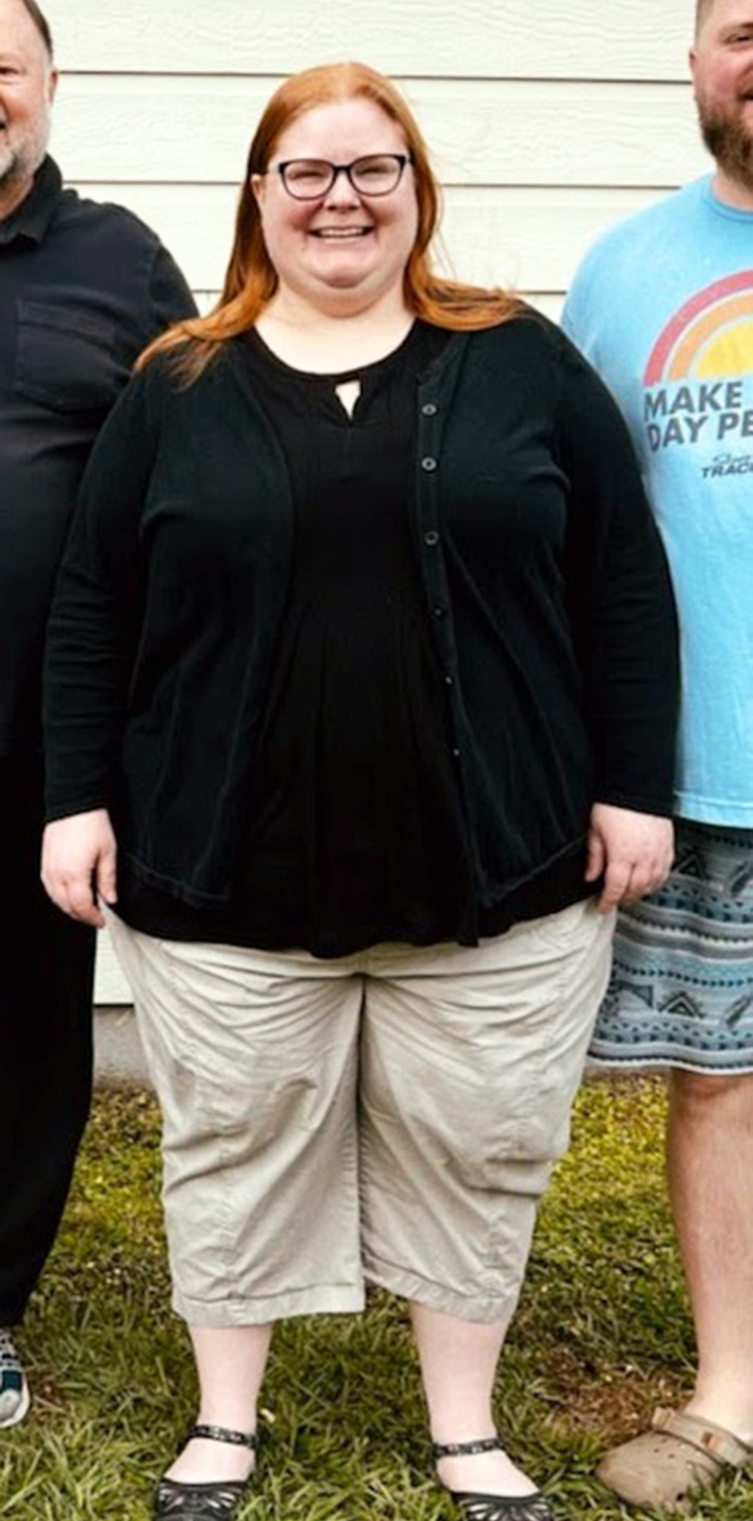 Woman Loses 220 Pounds With Rare Surgery That Leads to 'Dramatic ...