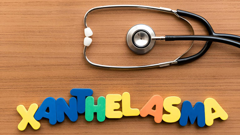 From Your Eyes To Your Ankles: Body Parts That Can Signal High Cholesterol