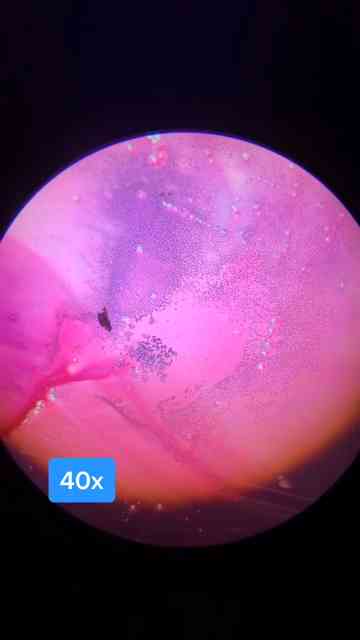 Mind-Blowing Things Under the Microscope!