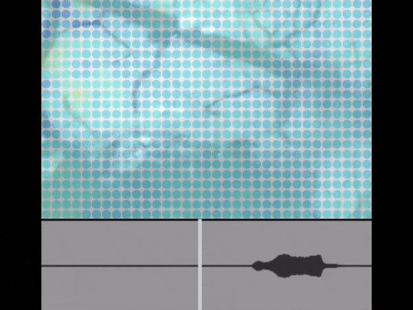 Precision Neuroscience, founded by Neuralink alums, is developing a ...