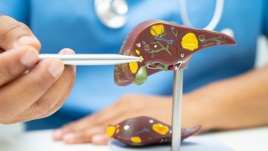 Supplements Taken by Millions Linked to Deadly Liver Disease