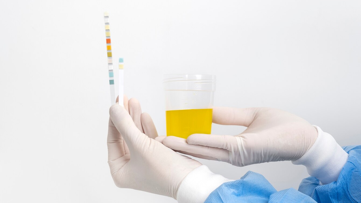Five Danger Signs To Watch Out For In Your Urine: Expert