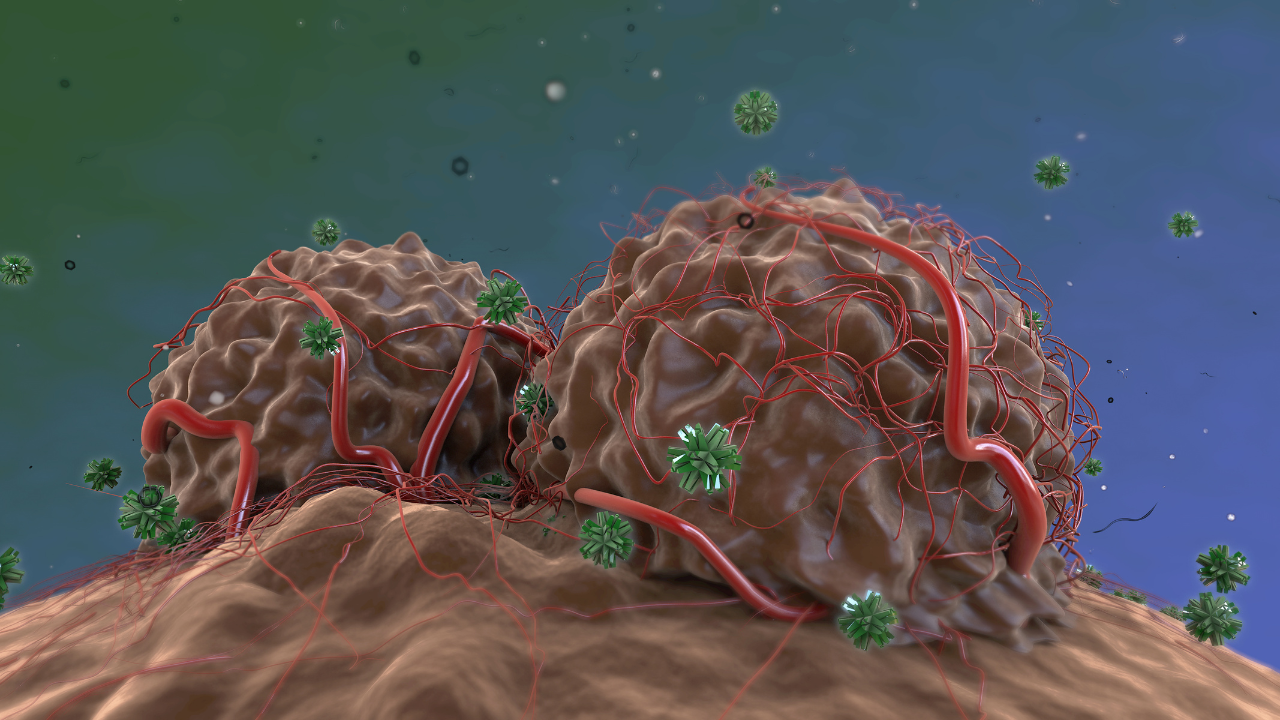 When a lump isn't a lump: Understanding pediatric soft tissue tumors