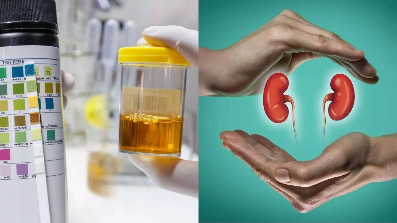 Urine colour and kidney problems: Signs you shouldn’t ignore