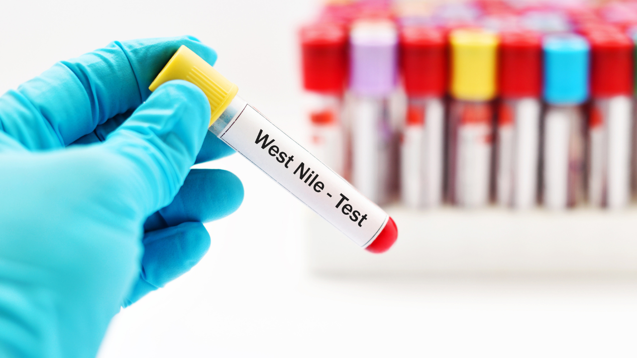First West Nile Virus Case Confirmed In Michigan: How Does The ...