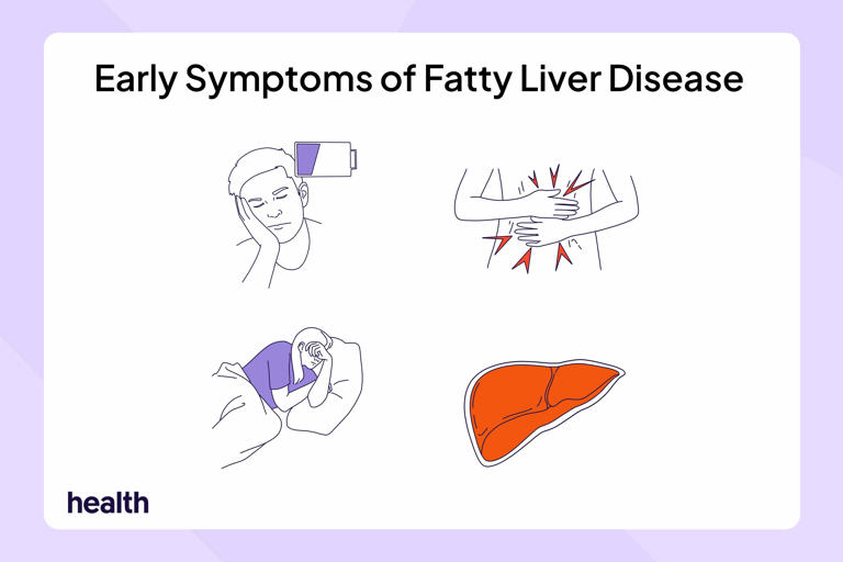 Could Your Fatigue Be From Fatty Liver Disease? Plus, 4 Other Early ...