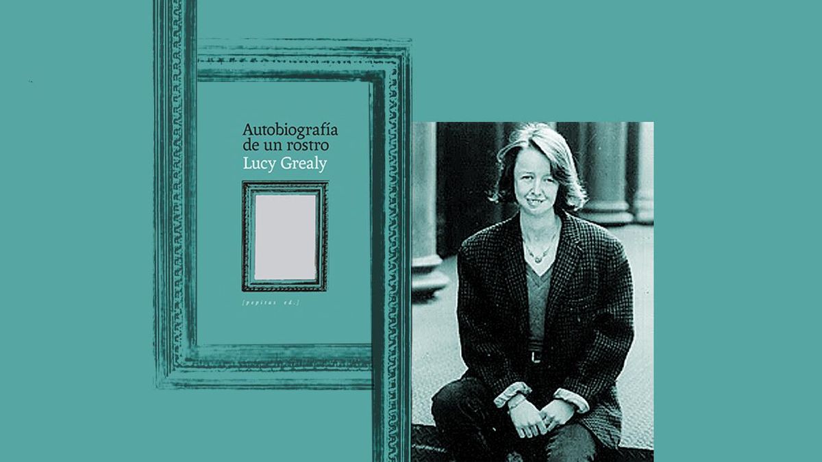 Volver A La Sociedad Con La Cara Desfigurada La Historia De Lucy