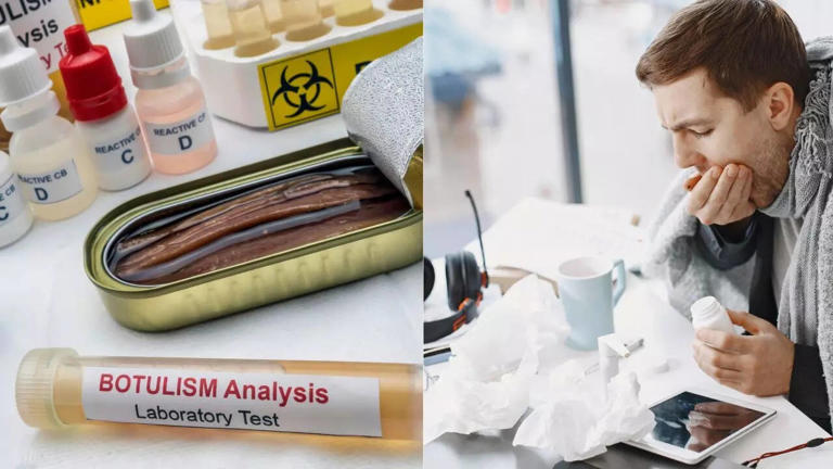 What is botulism? Understanding causes, symptoms, and why early ...