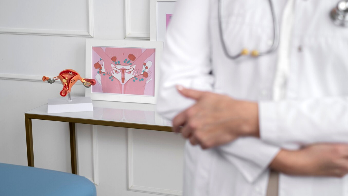 How Long Can You Delay Uterine Fibroid Surgery? A Gynaecologist Explains