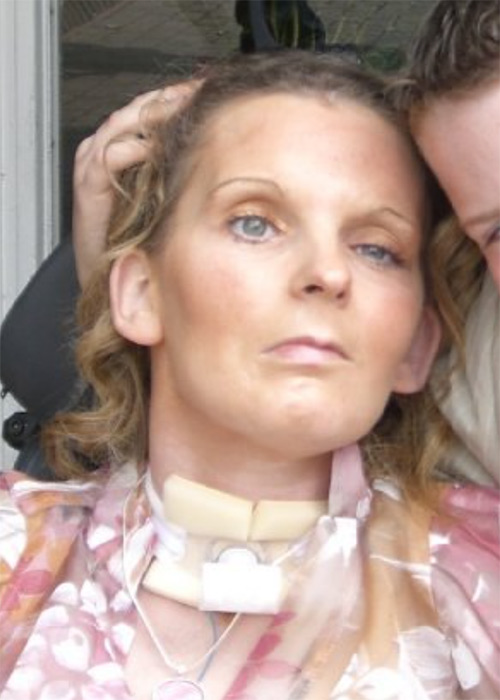 Catherine O’Leary who lived with locked-in syndrome for 17 years dies