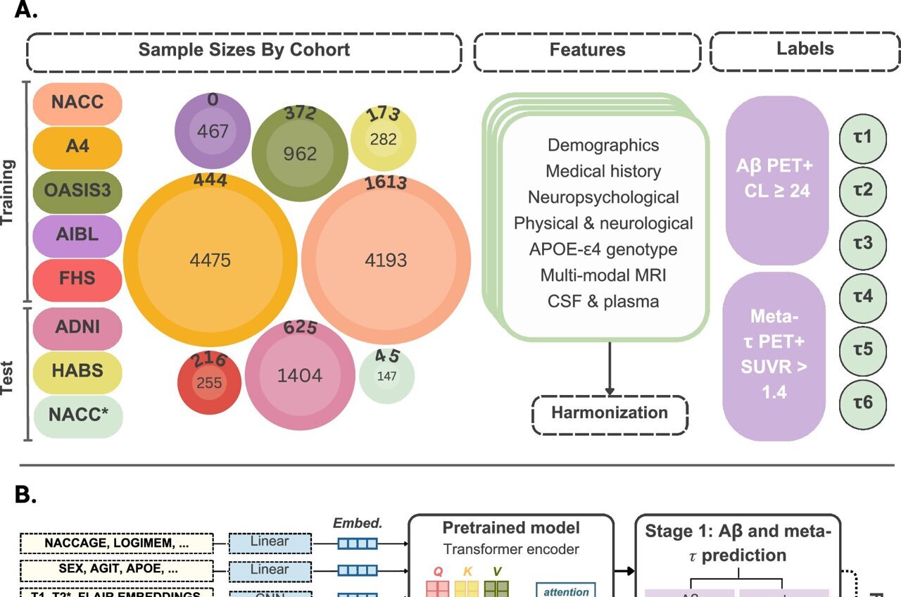 Cost-effective AI tool can predict markers of Alzheimer's disease