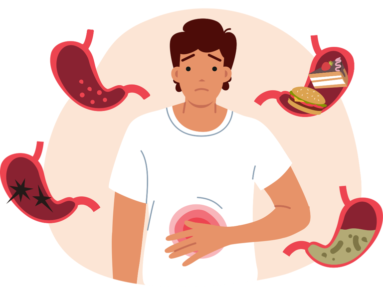 ¿Qué es el empacho, síntomas y cómo se puede curar?