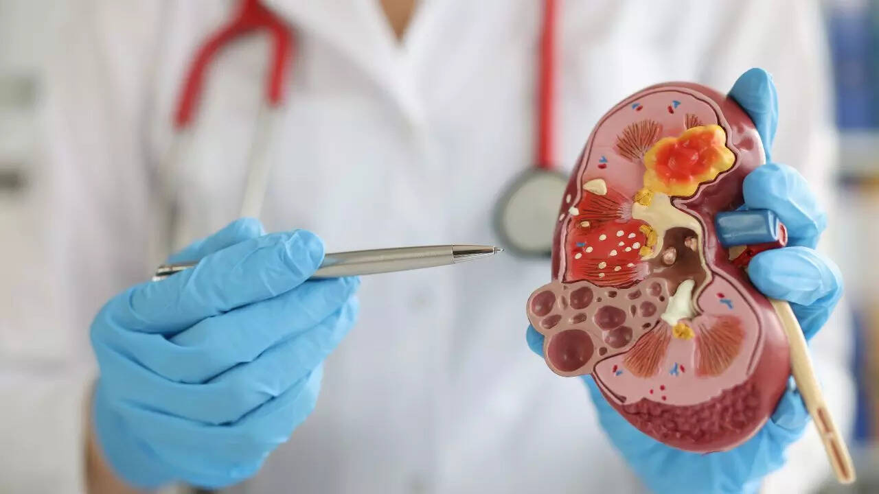 What happens after a kidney transplant? Know precaution tips ...