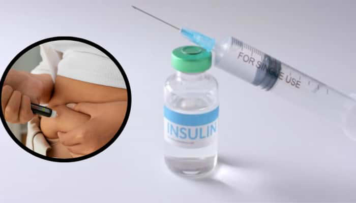 6 Early Warning Signs Of Insulin Resistance You Should Never Ignore For Better Blood Sugar And ...