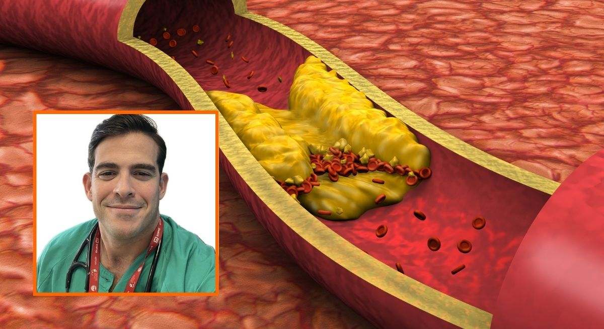 Aurelio Rojas, cardiólogo: "Si tienes alguno de estos signos en tu ...