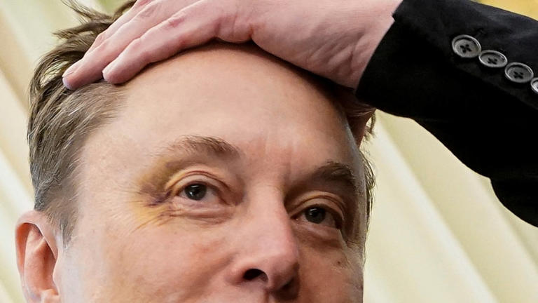 Bessent Addresses Musk’s Mysterious Black Eye After Their White House Brawl