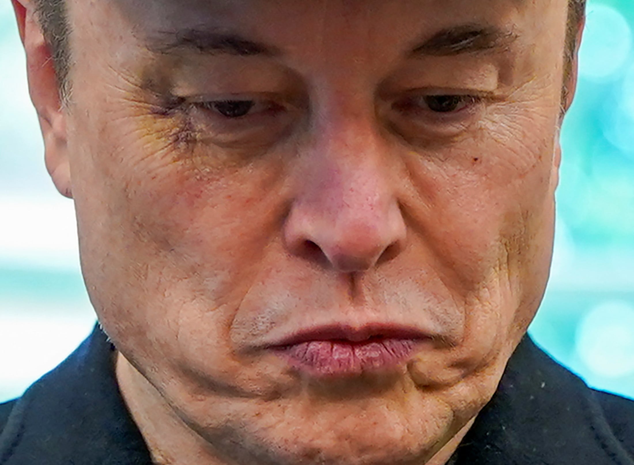 Bessent Addresses Musk’s Mysterious Black Eye After Their White House Brawl