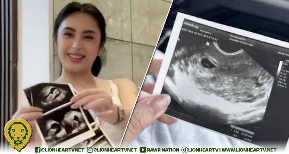 Bea Borres speaks out, says viral transwoman post on ‘menstruation’ and ...
