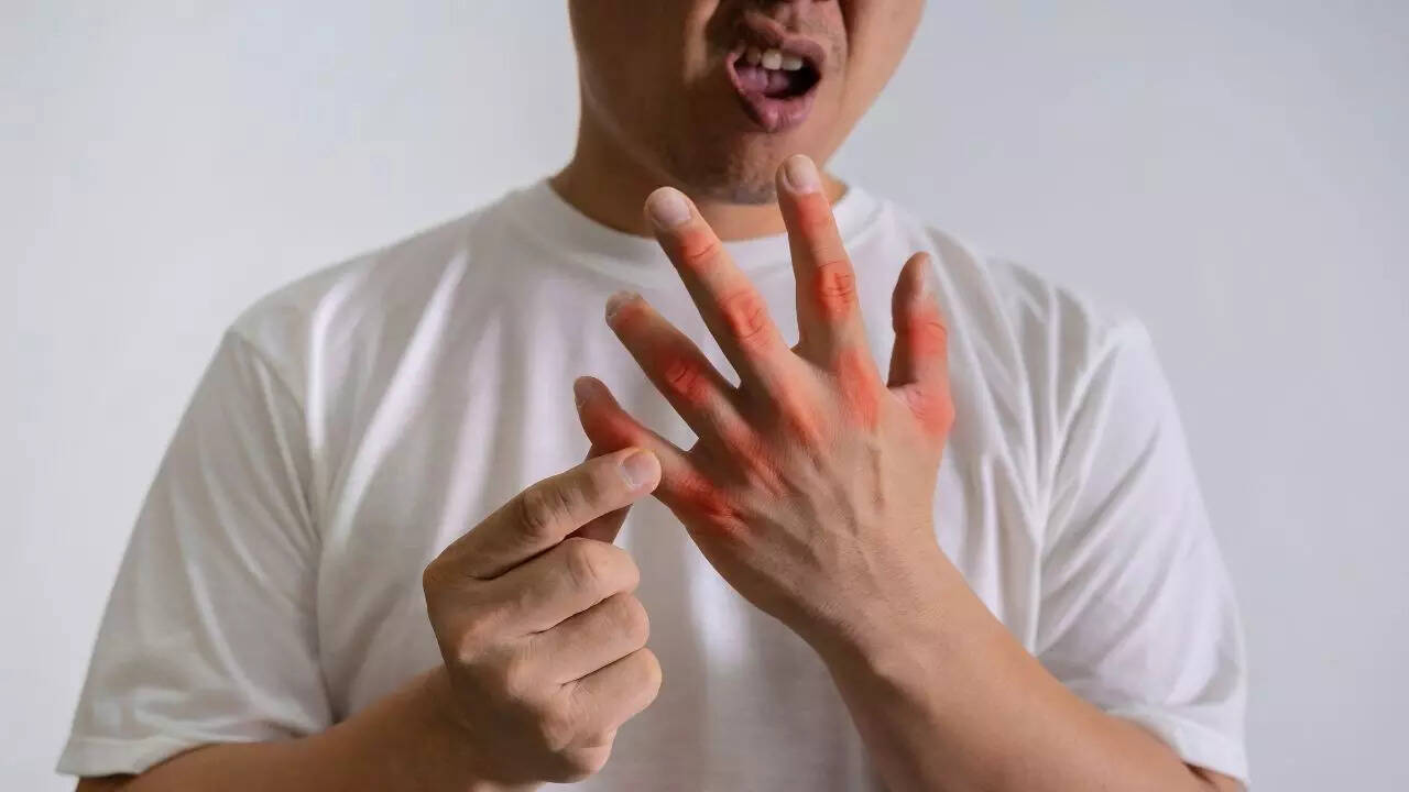 7 early symptoms of high uric acid your body gives before a blood test ...