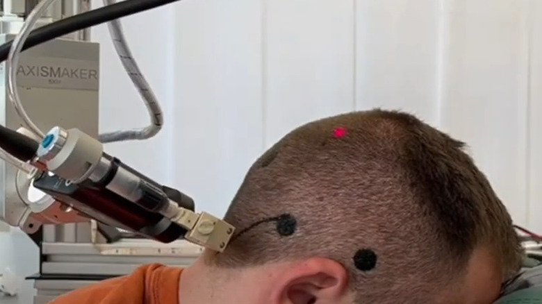 What Is An Electric Tattoo & How Does It Work?