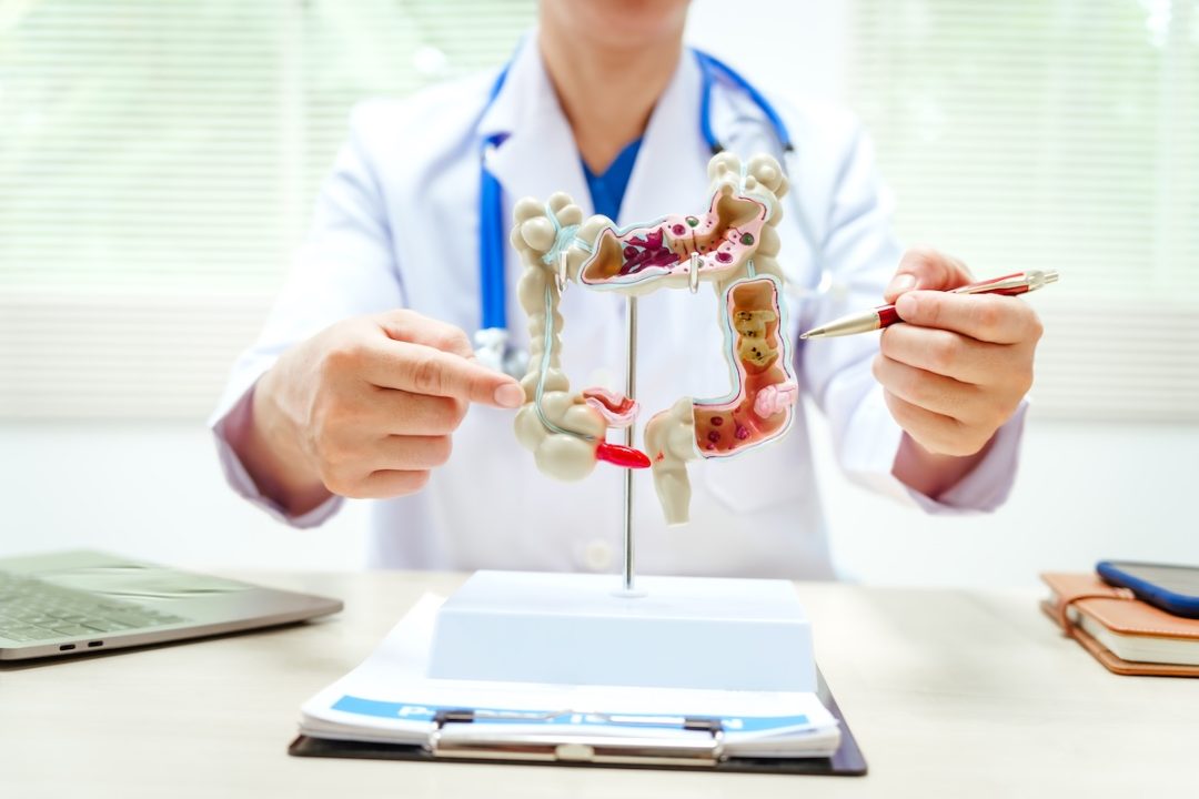 Colon Cancer Vaccine Gets One Step Closer to Reality
