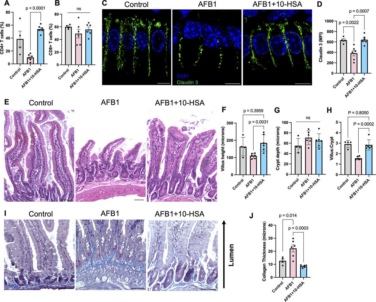 Microbial molecule may offer non-toxic way to restore liver and gut health
