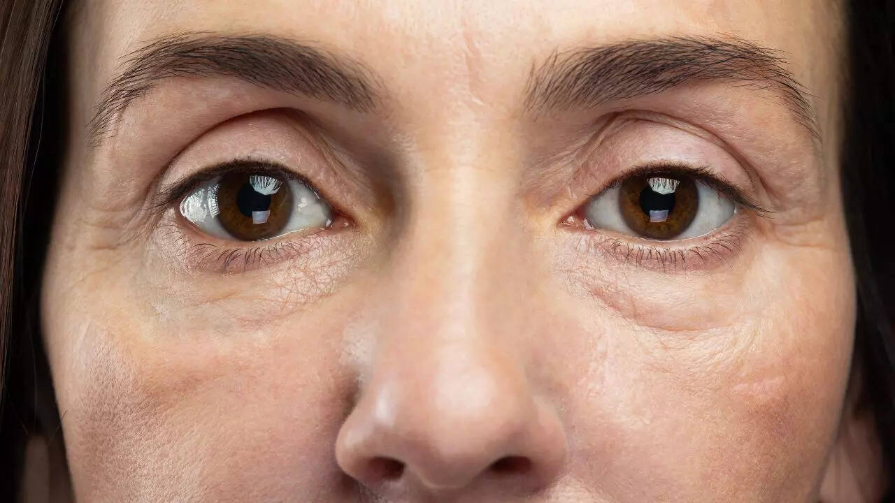 Are eye floaters a warning sign of high blood pressure and diabetes ...