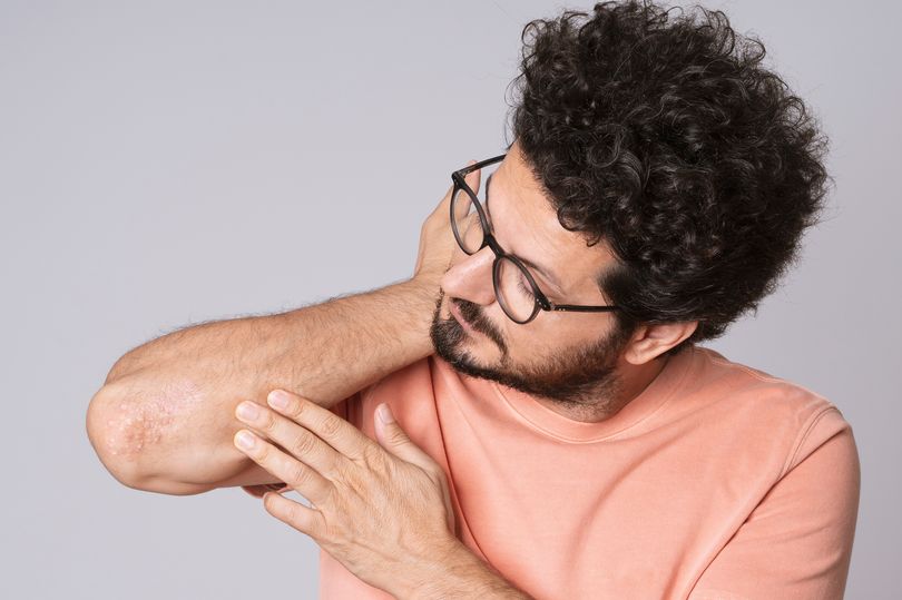 Cancer alert as doctor says watch for three signs on the skin