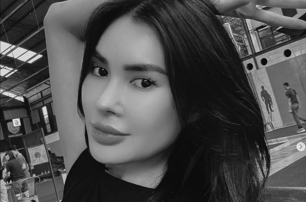 Michelle Halim Spill Bagian Tubuh yang Dioperasi Plastik Plus Budgetnya ...