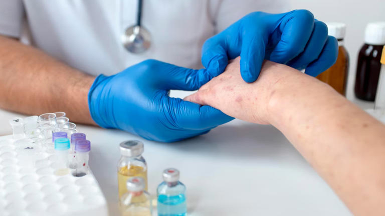 Signs You Should Get A Skin Patch Test: What To Expect During The Procedure