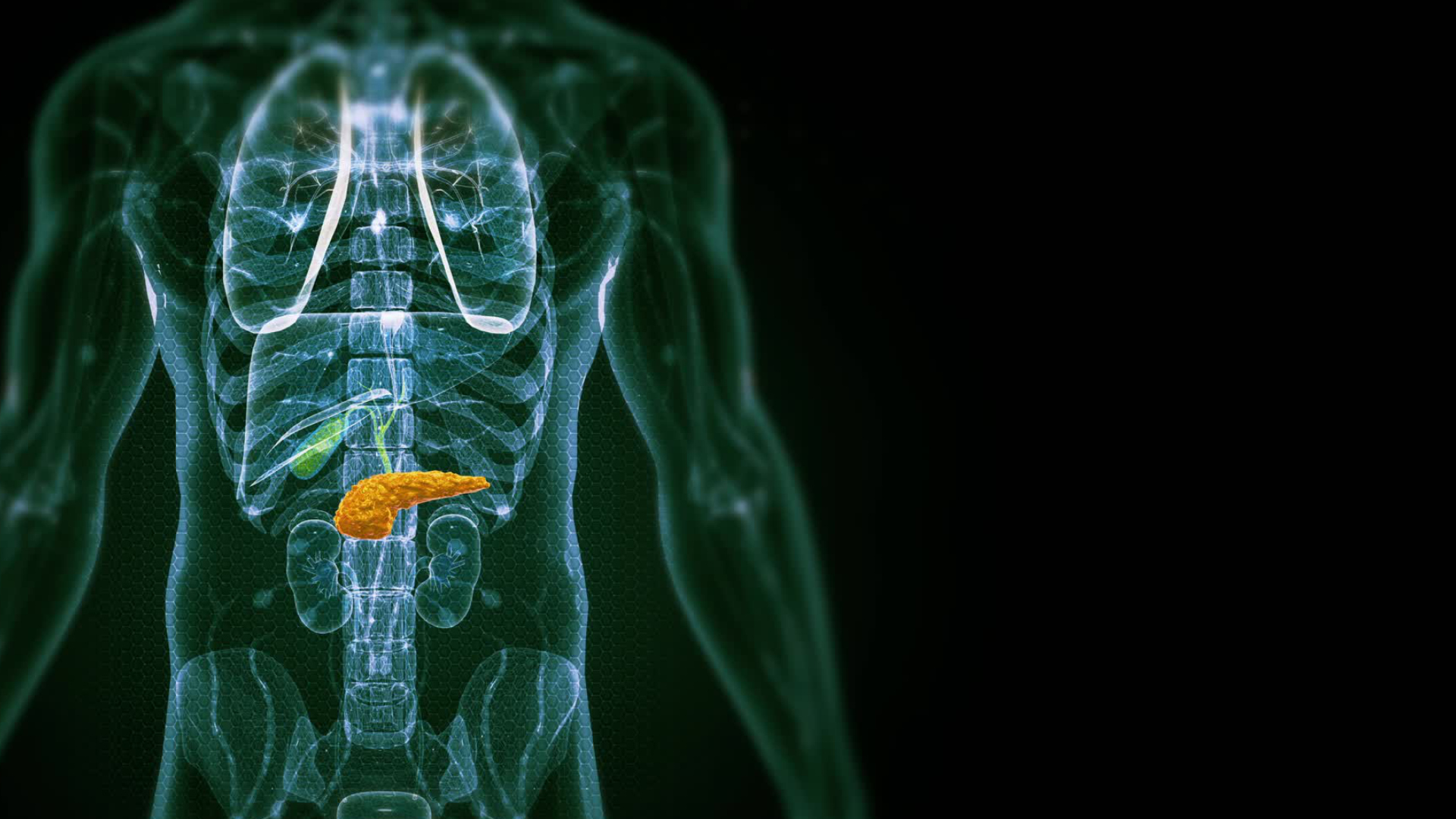 New Pancreatic Cancer Vaccine Shows Promise in Early Trial, Offering ...