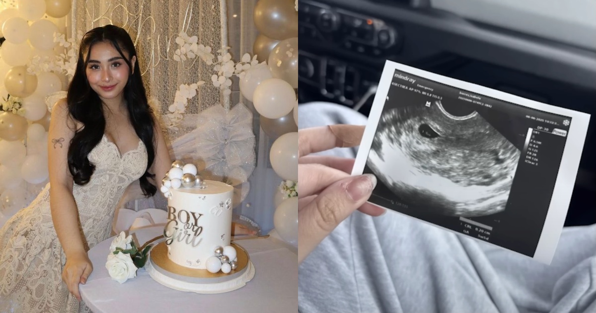 Bea Borres not open to co-parenting with anyone after revealing pregnancy