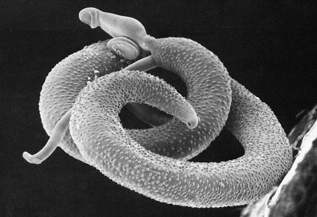 Scientists discover how terrifying cancer-causing parasitic worm can ...