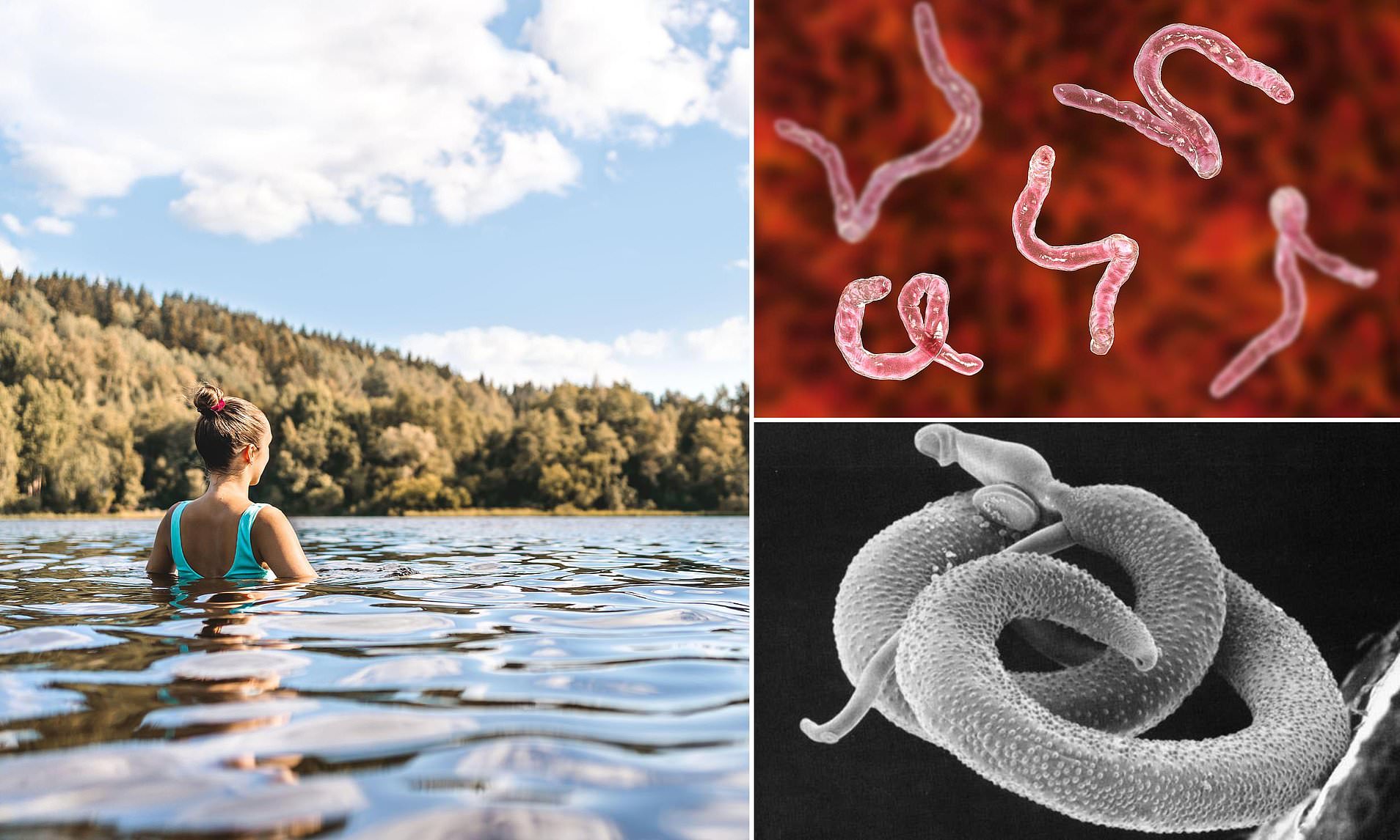 Scientists discover how terrifying cancer-causing parasitic worm can ...