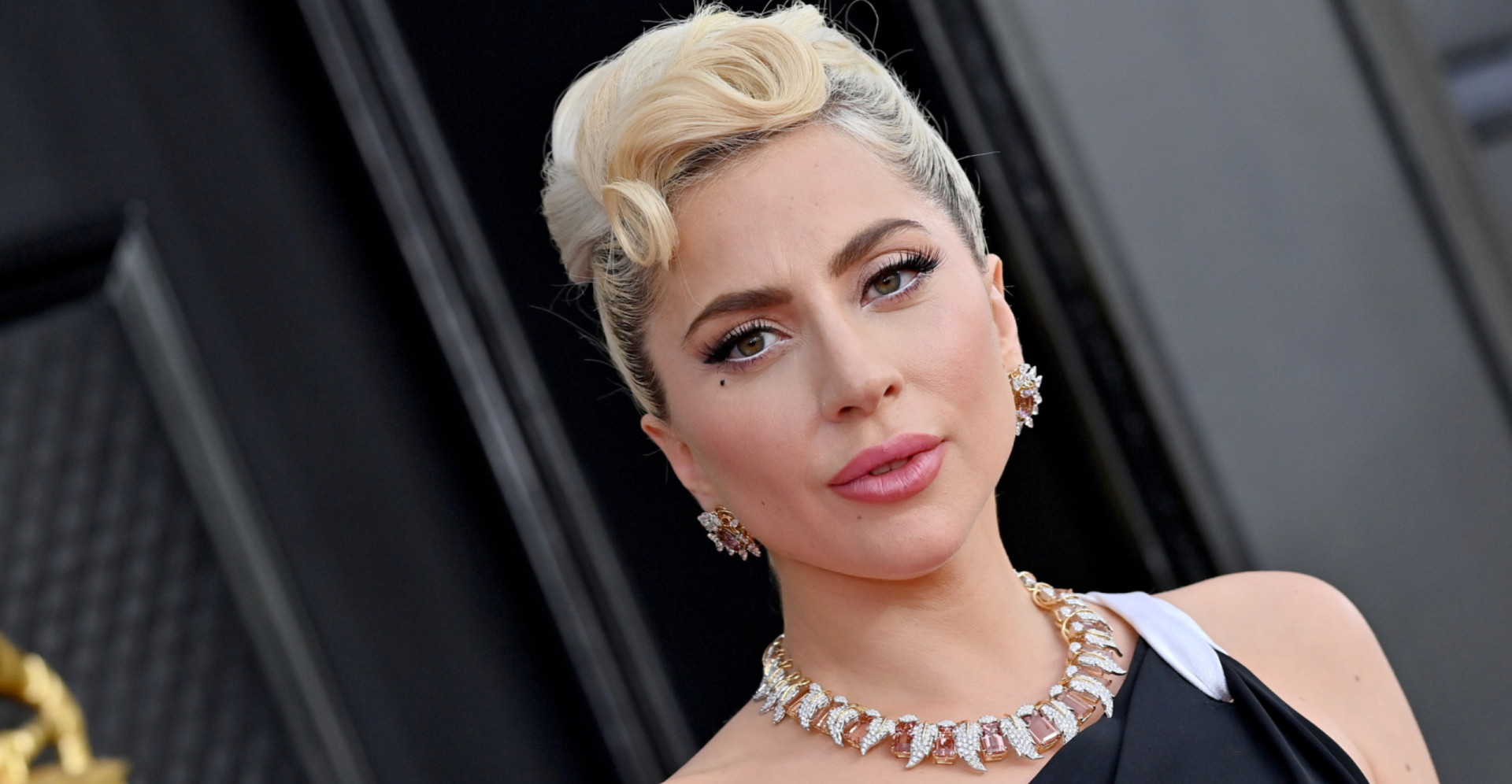 These celebrities live with chronic illnesses