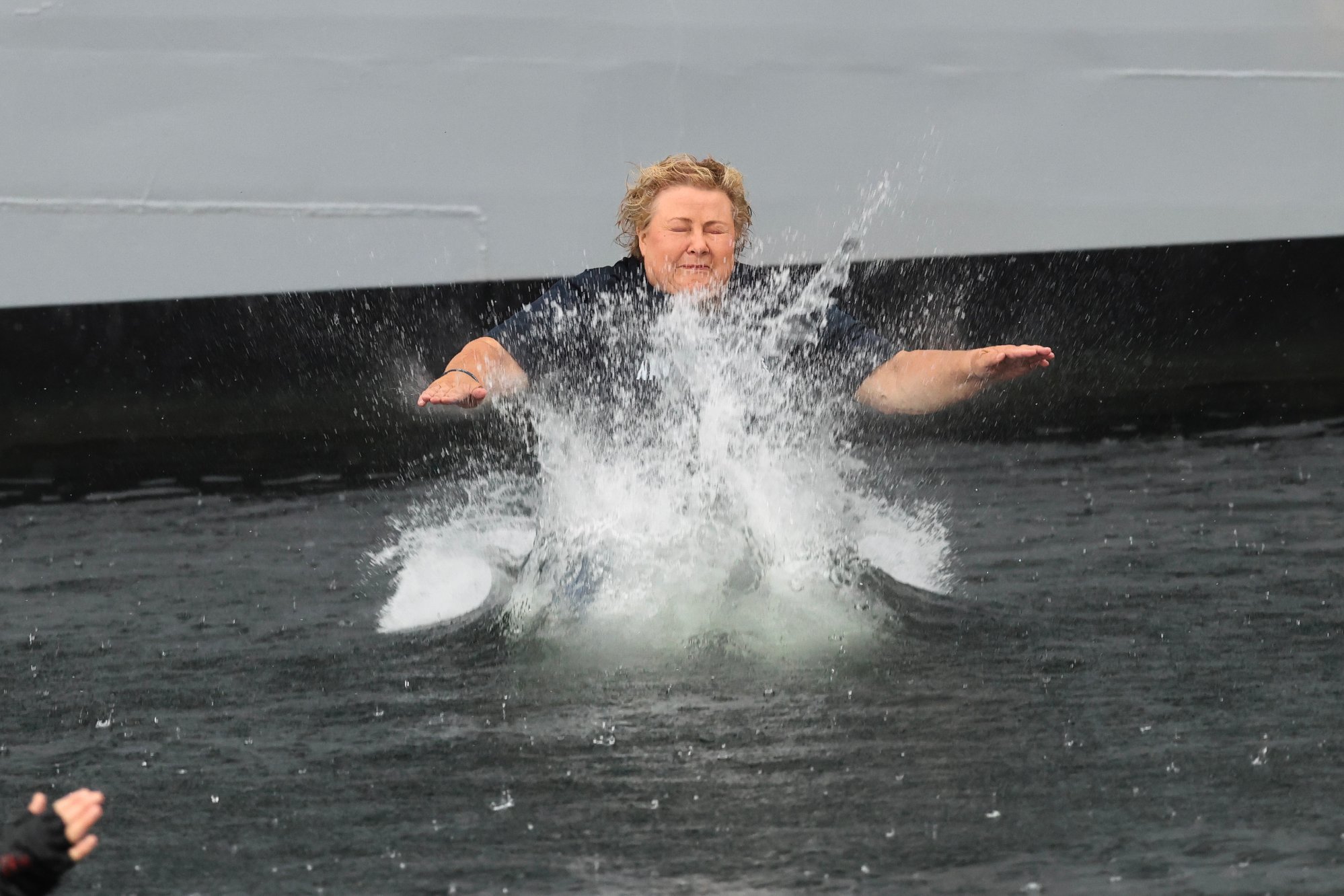 Mageplask for Erna – verste på 16 år